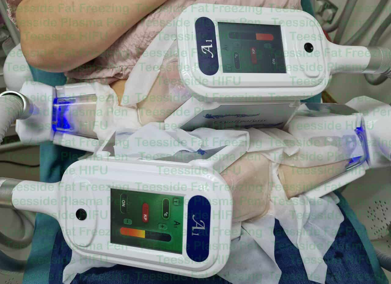 BellyBuster® - Teesside Fat Freezing